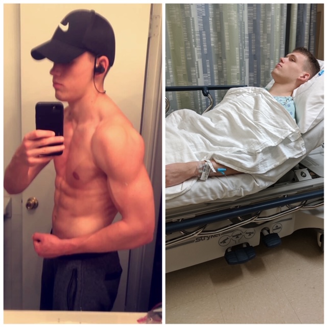 Revitalizing a Fallen Athlete (Part 2 of 4) - Kee On Sports Media Group
