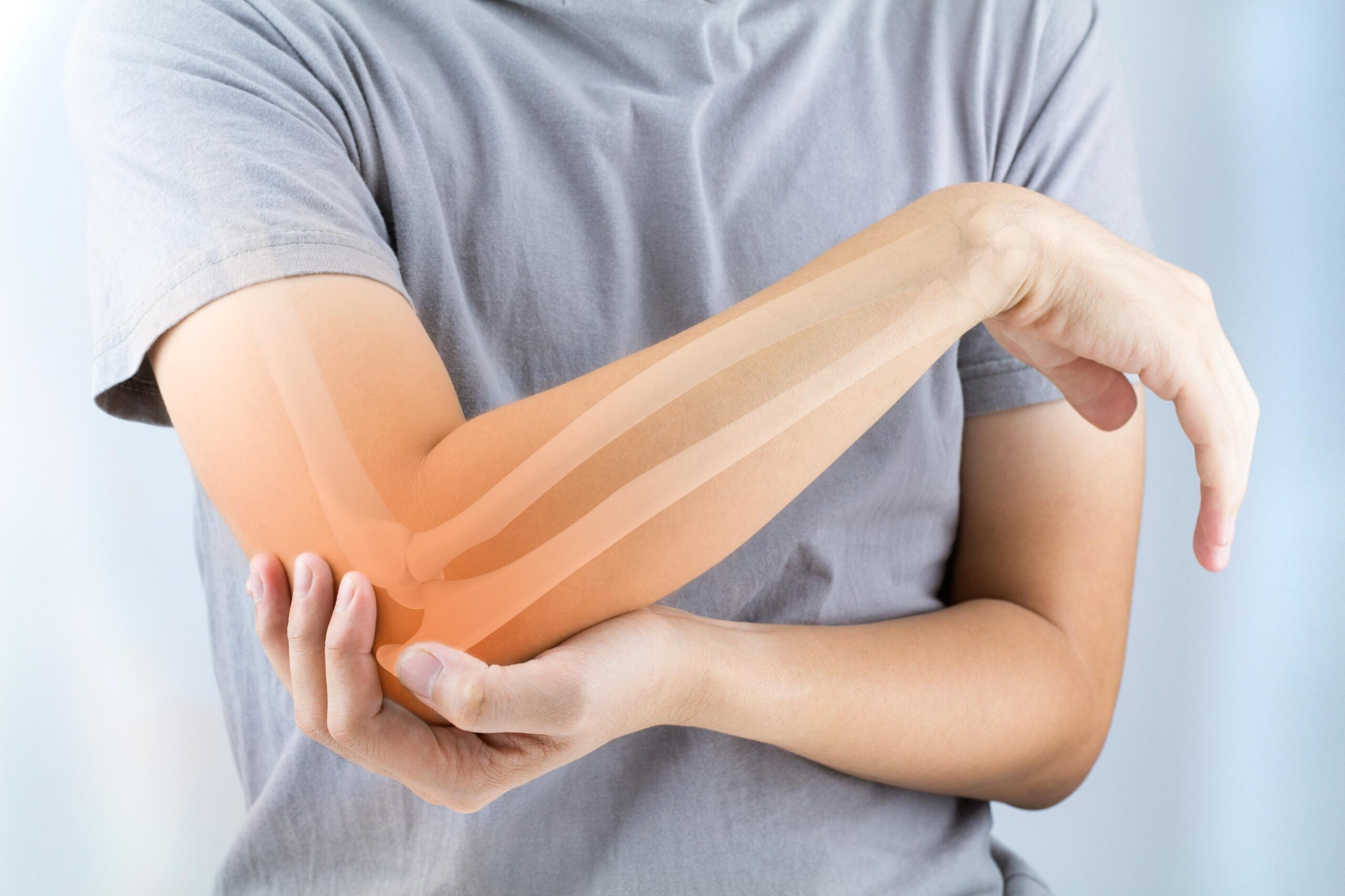 Understanding Tennis Elbow in Sports: What Athletes Should Know - Kee ...